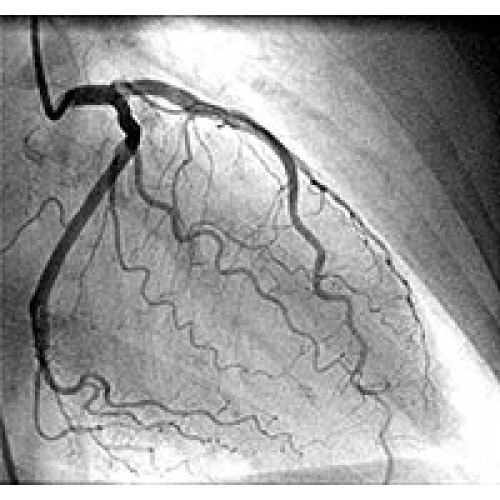 Fluoroscopic Radiation Safety Training-Cardiology Version